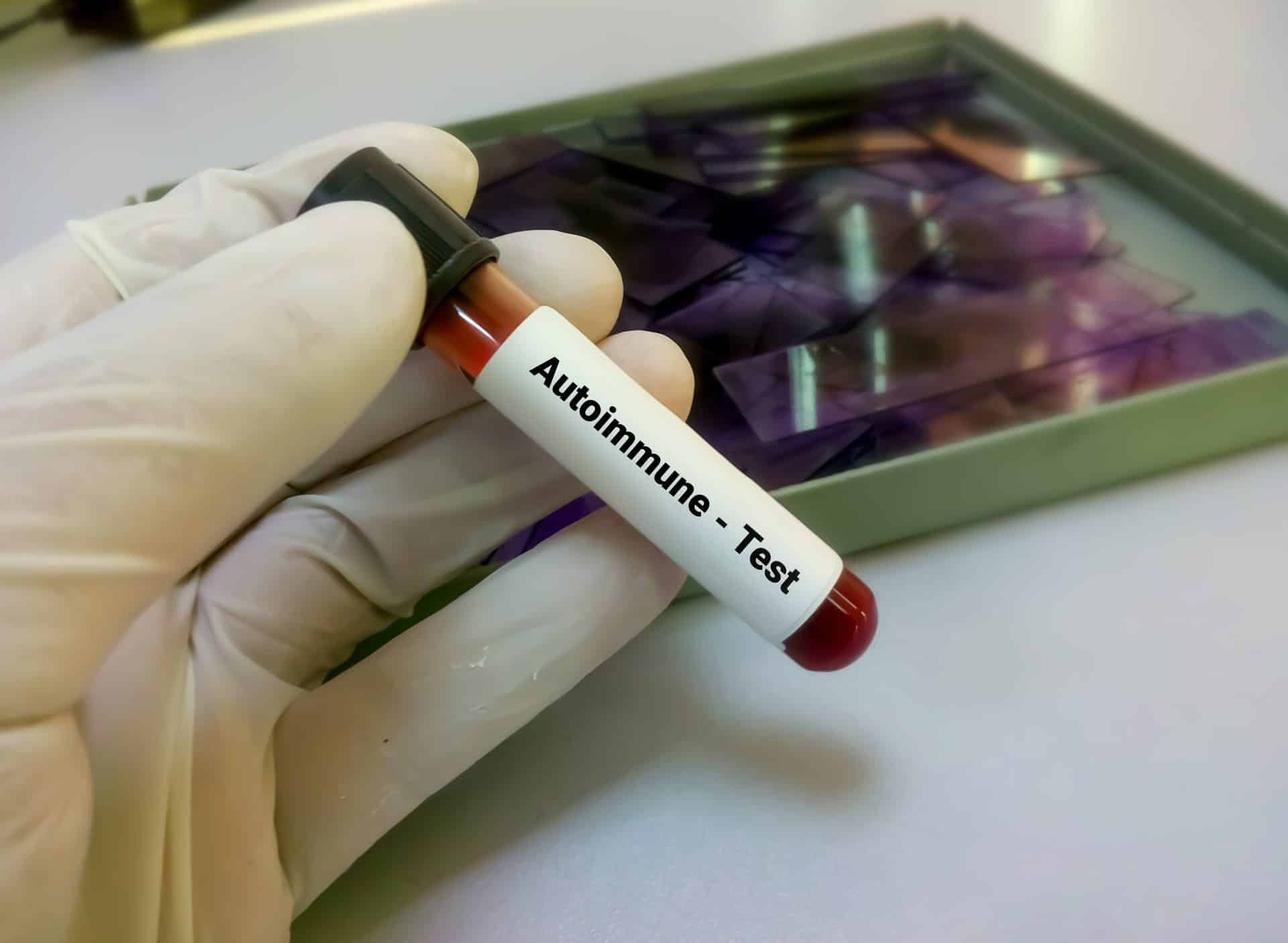 Efgartigimod Discovered as an Effective Drug for Autoimmune Blood ...