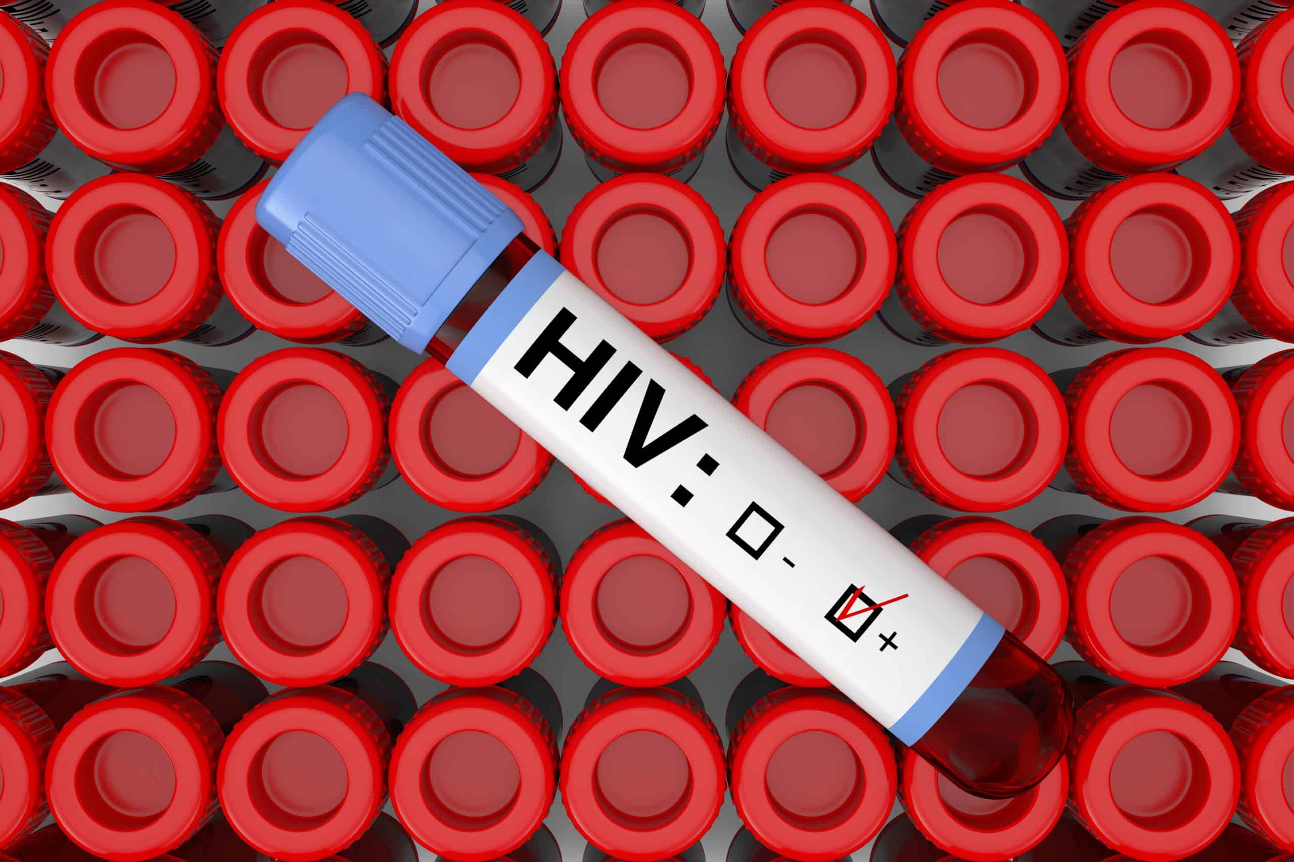 Meta-Analysis Reveals Effective Strategies for Demand Creation of HIV ...