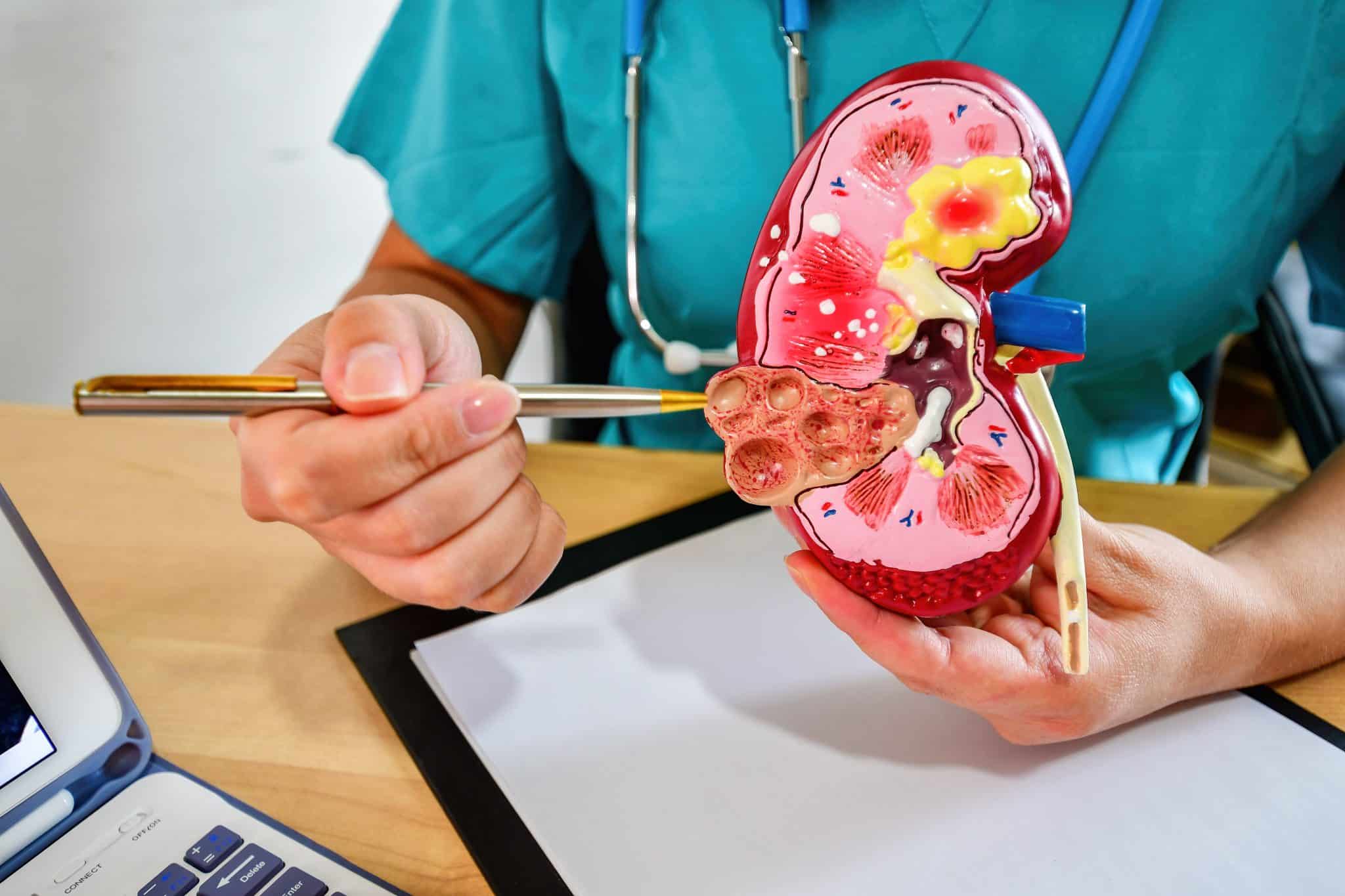 Personalized Medicine in Pediatric Nephrology How Urinary DKK3 is ...