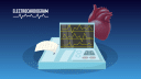 How to distinguish between normal and abnormal ECG signals | medtigo