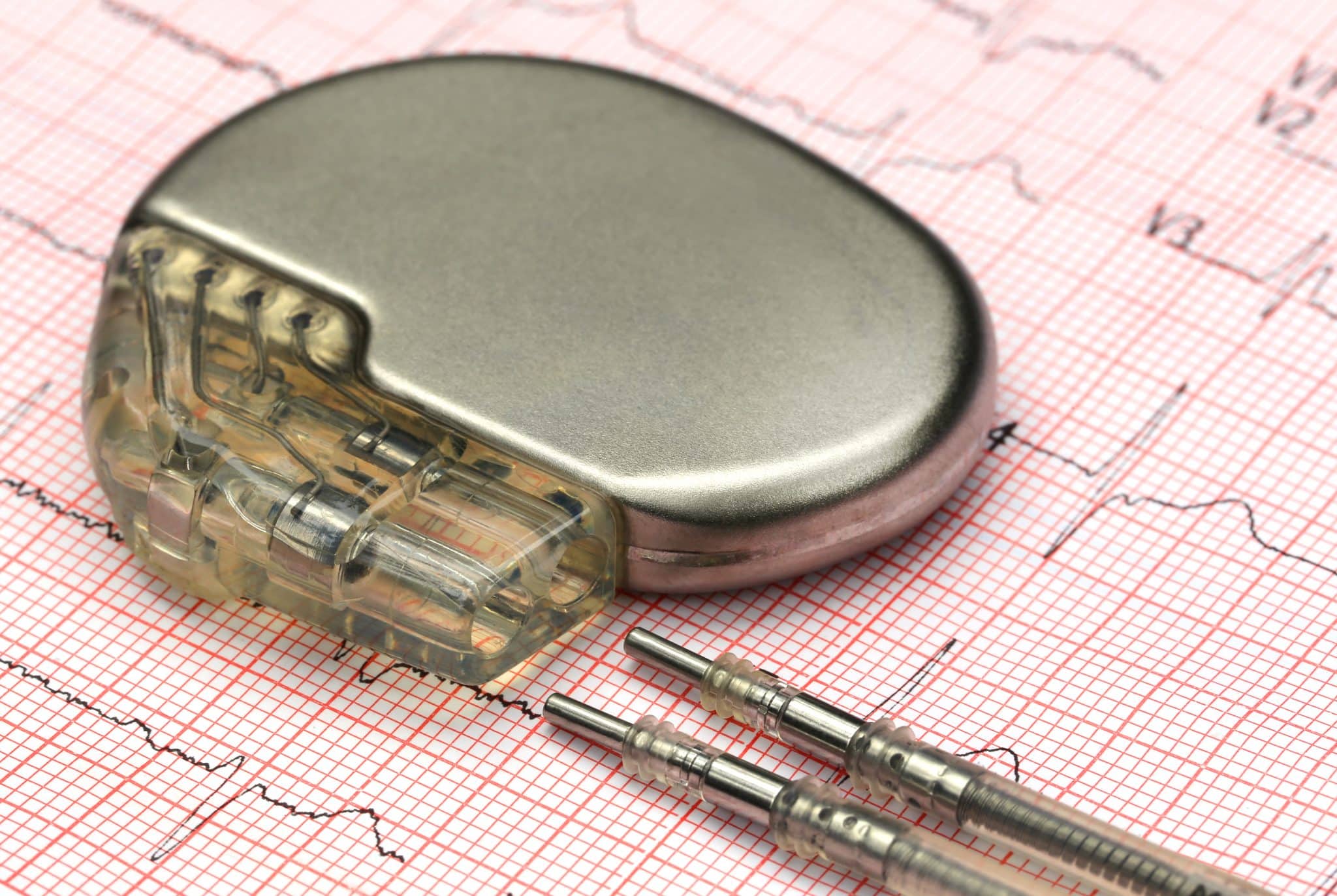 Dual-Chamber Leadless Pacemakers: Safe and High-Performing | medtigo