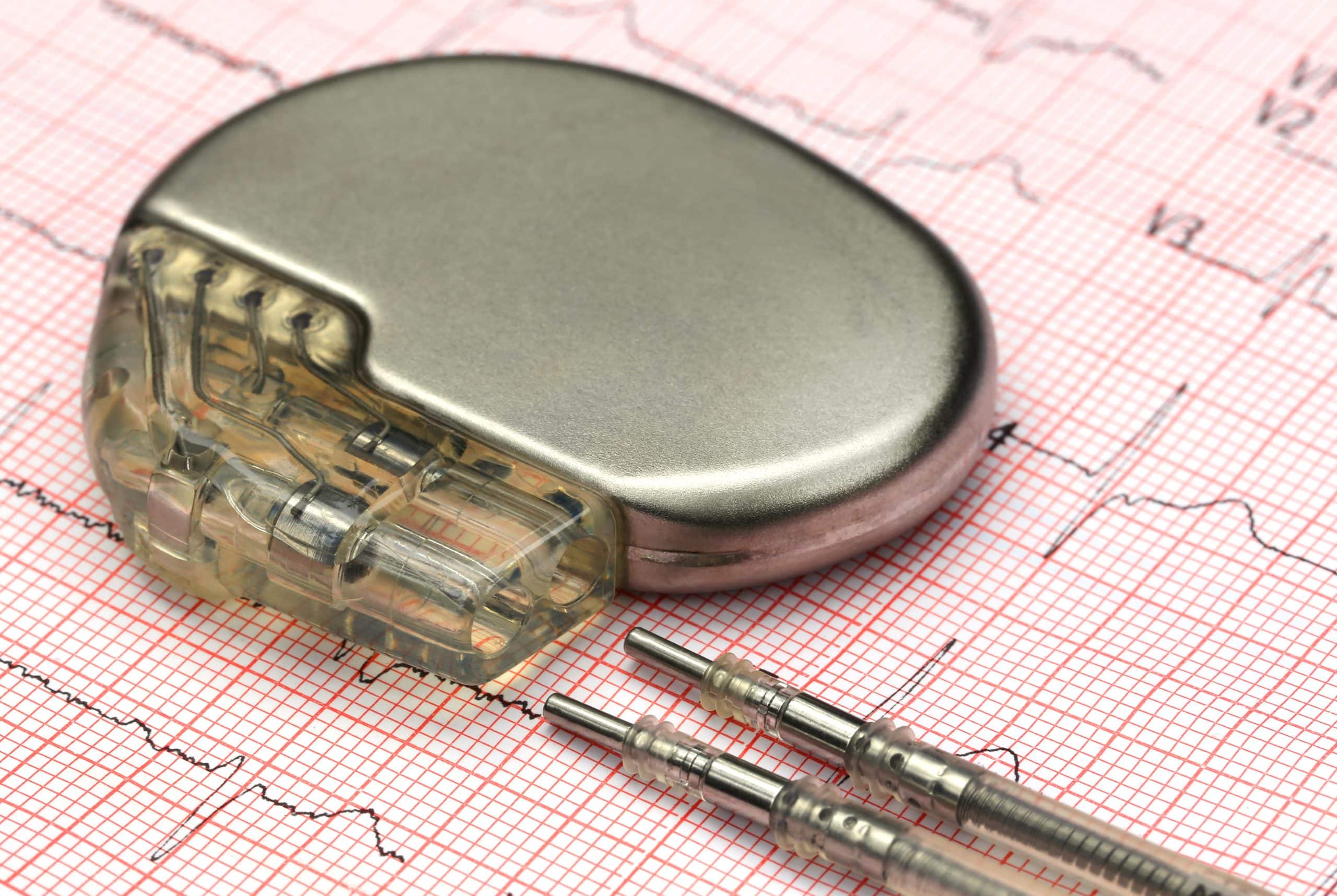 Dual-Chamber Leadless Pacemakers: Safe and High-Performing | medtigo
