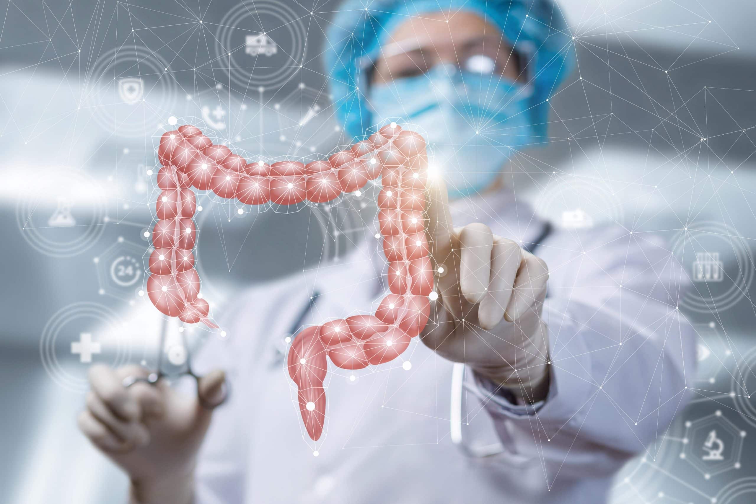 Preoperative Treatment Approach For Rectal Cancer Discovered: Study ...