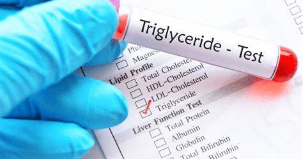 Surprising Link: Triglycerides and Dementia Risk