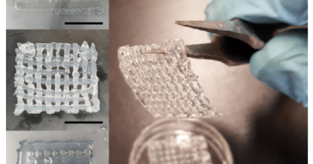 Revolutionizing Soft Tissue Regeneration with Biomimetic Scaffolds
