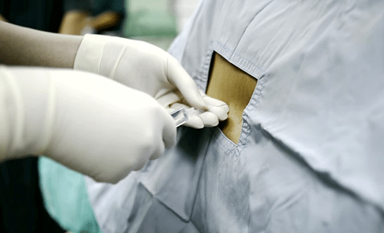 Lumbar Puncture | medtigo