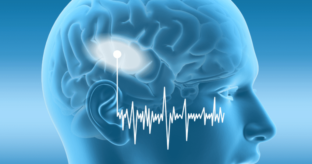 Decoding Speech: DNN Insights into Auditory Cortex Coding