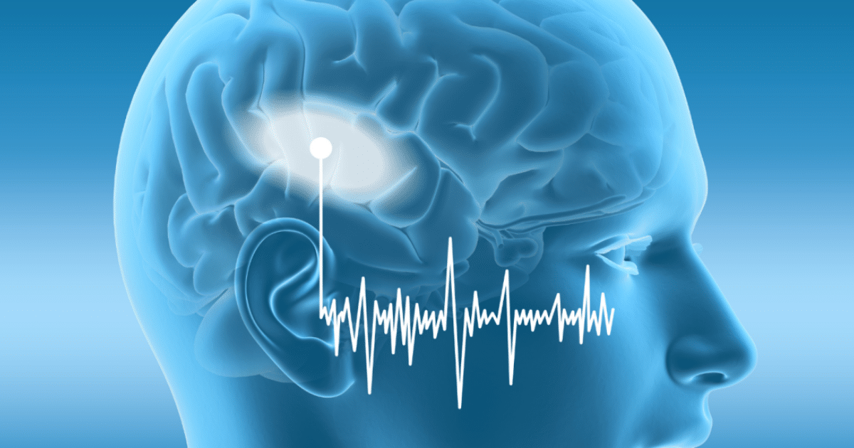 Decoding Speech: DNN Insights into Auditory Cortex Coding