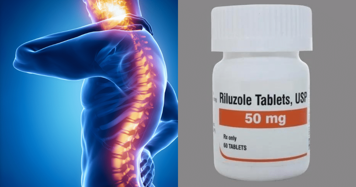 Promising Results with Riluzole for Acute Spinal Cord Injuries