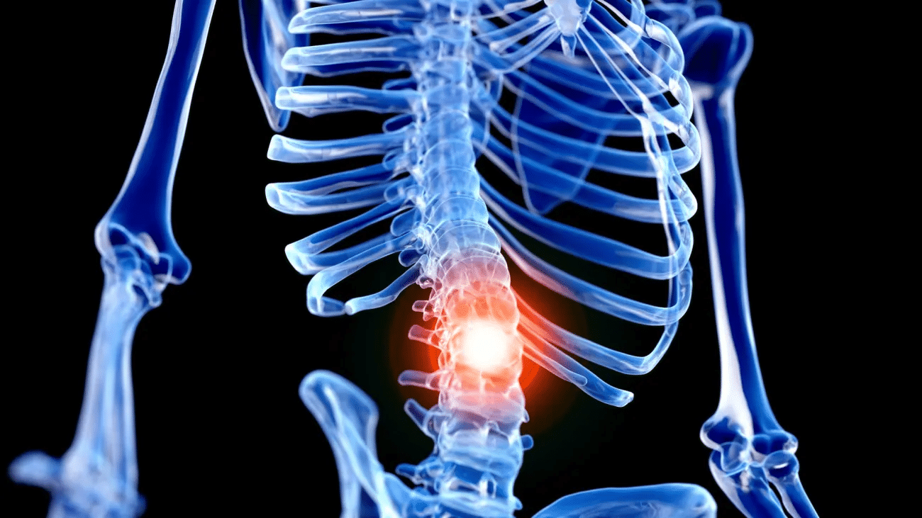 Back Pain Traced to Unique Cell Subtype in Spinal Discs | medtigo