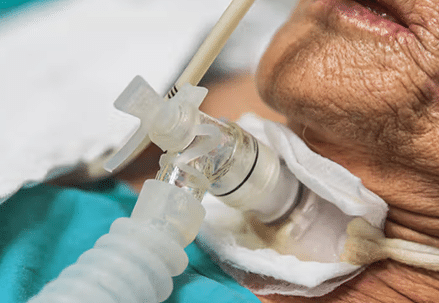 Surgical Airway Management | medtigo