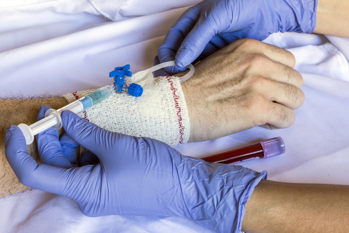 Iodine Povacrylex Reduces Infections in Fracture Surgeries | medtigo