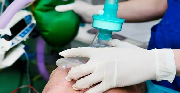 Inhalational and Balanced Anesthesia Procedure | medtigo