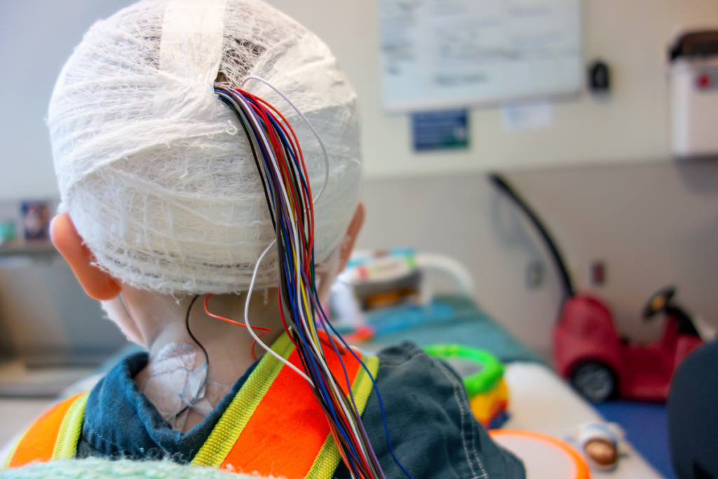 FDA Approves Nasal Spray for Epilepsy Patients Aged 2–5 | medtigo