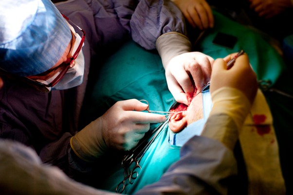 Modified Radical Neck Dissection | medtigo