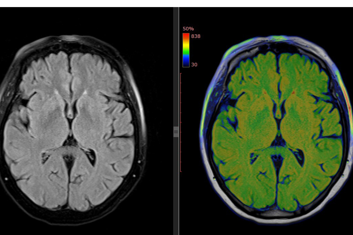 The Next Leap in Brain Imaging Technology | medtigo