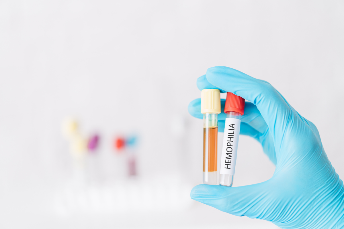 FDA Greenlights Alhemo: A New Daily Shield Against Hemophilia A & B ...