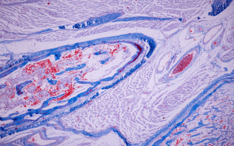 Engineered Human Cartilage–Derived Acellular Grafts for Immunomodulated ...